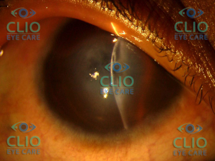 Gallery | Clio Eye Care